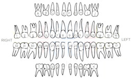 Labeled Chart Of Teeth Inside The Mouth