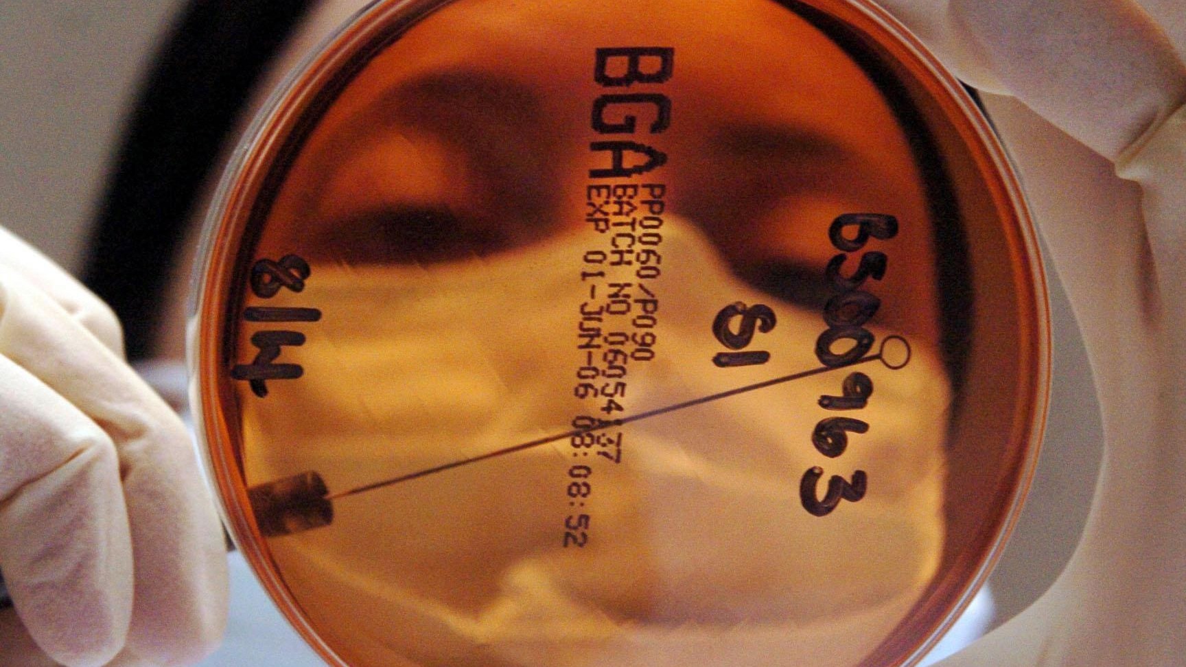 Discovery Helps Scientists Take First Steps Towards Urine Test For