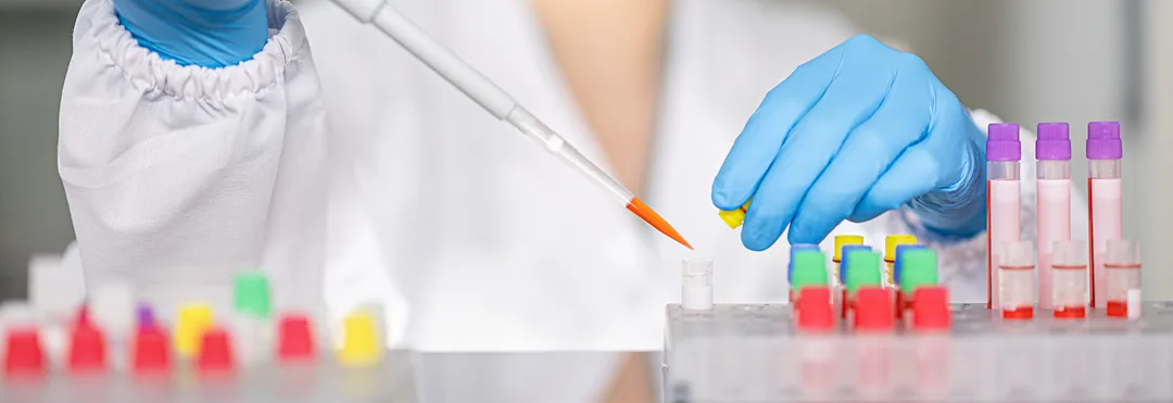Prepared sample tubes for venous blood sampling | SARSTEDT
