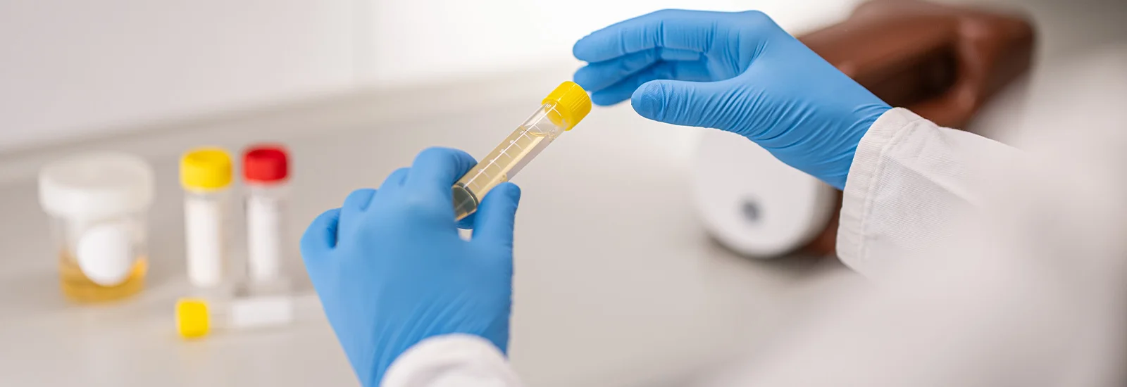 Urine tubes for urine collection | SARSTEDT