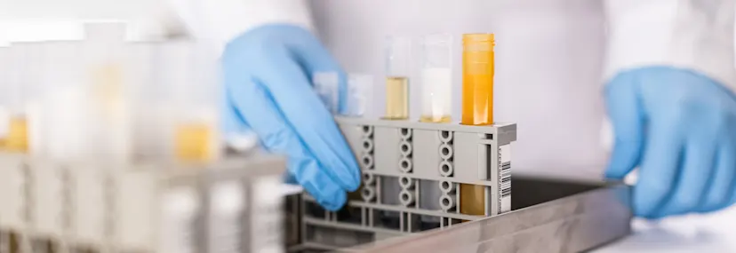 Secondary tubes for blood sampling | SARSTEDT