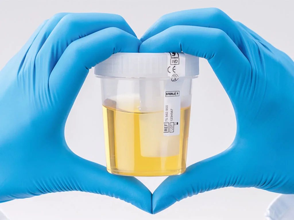 Urine sample instructions | SARSTEDT