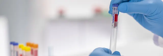 Carrier tubes for blood sampling | SARSTEDT