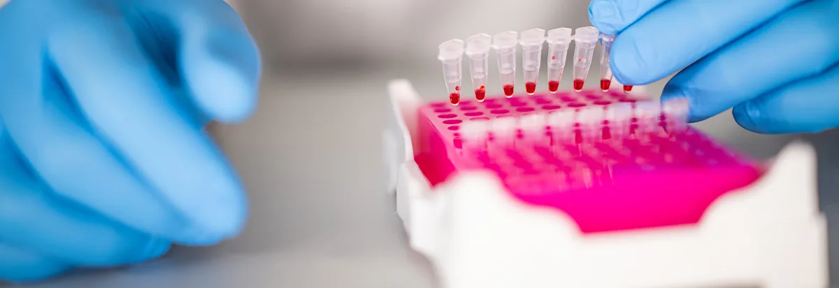 PCR racks for laboratory work | SARSTEDT