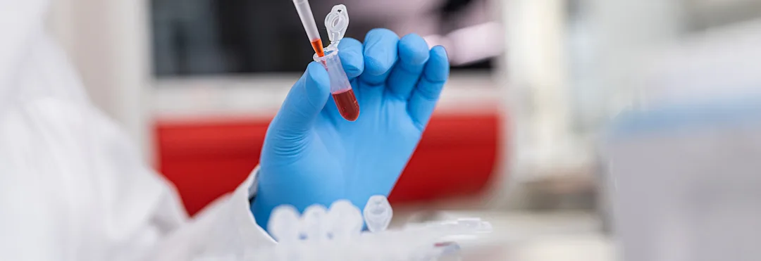 Reaction Tubes for sample handling | SARSTEDT