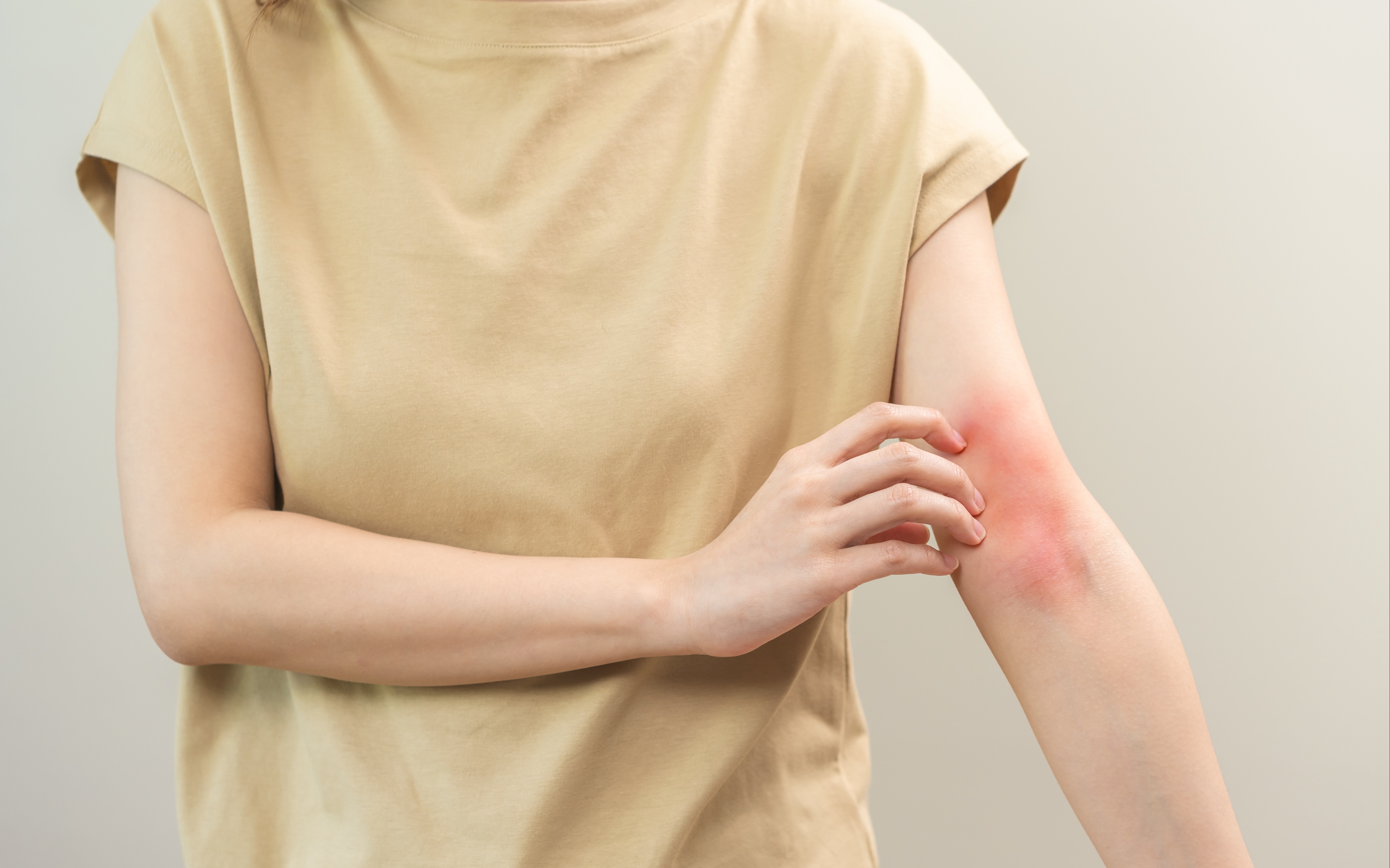 Quelle allergie provoque des plaques rouges ? - Aroma Zone