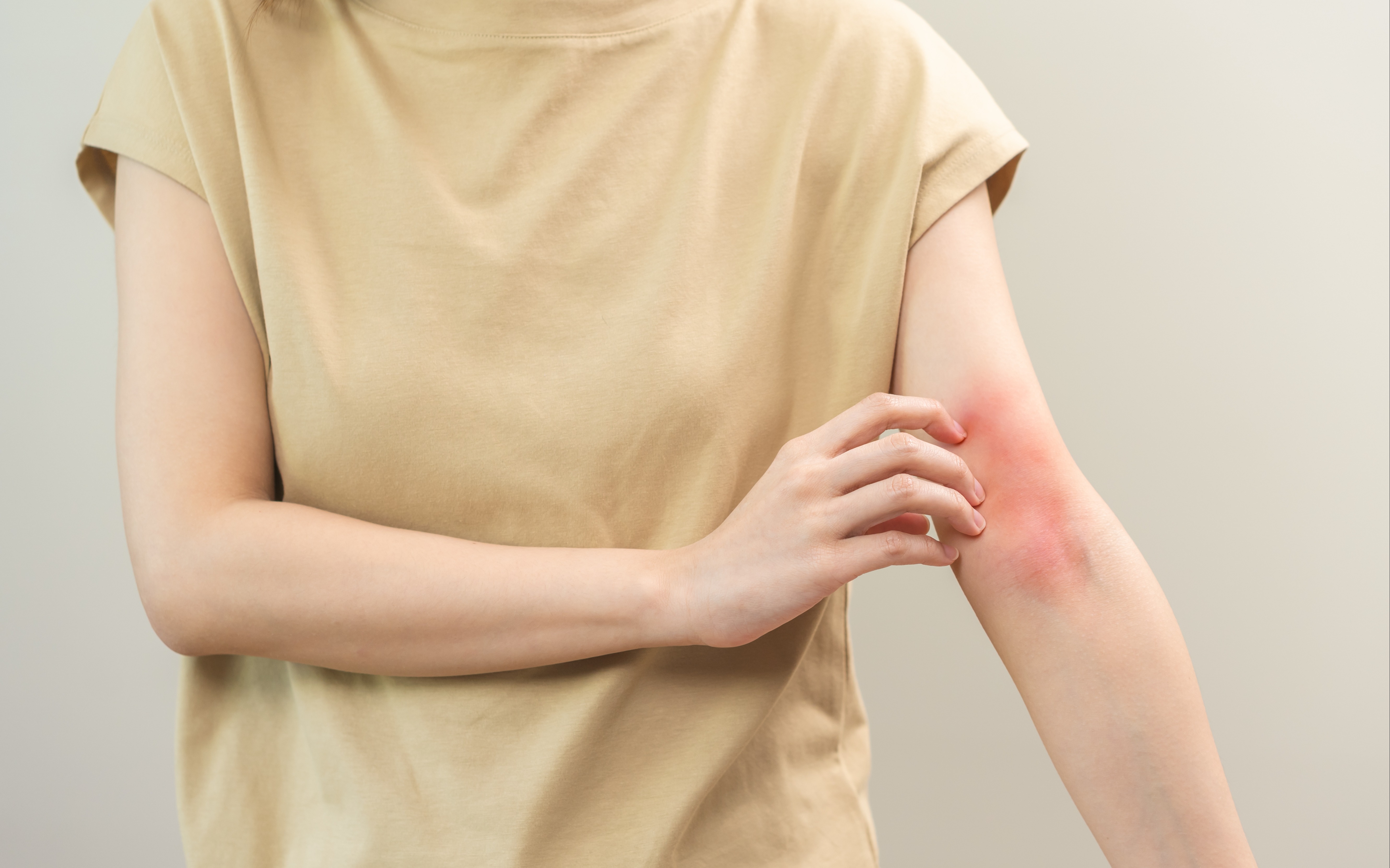 Macchie rosse sulla pelle e allergia: qual è il legame? - Aroma-Zone