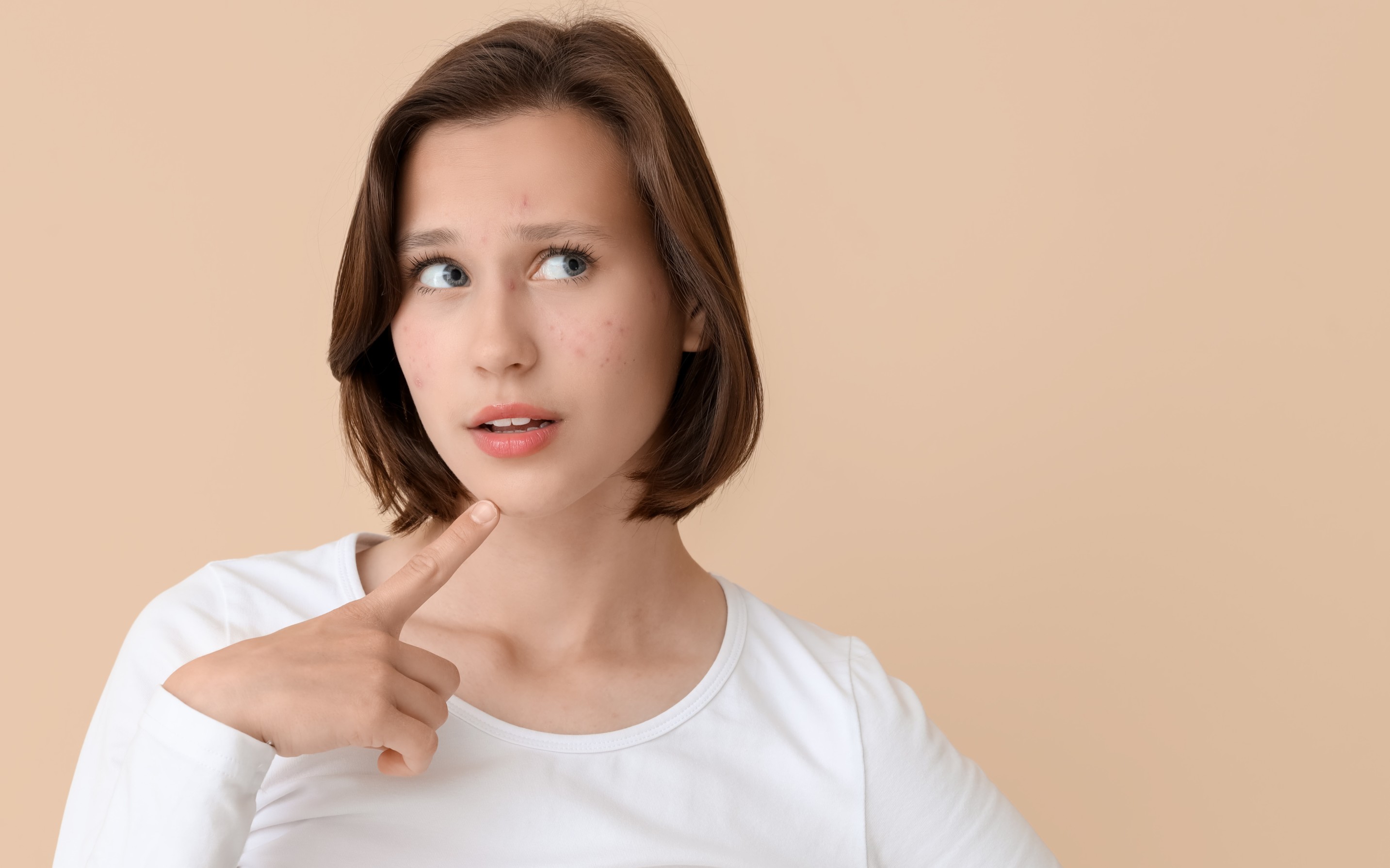 Bouton sur le menton : causes et traitement naturels