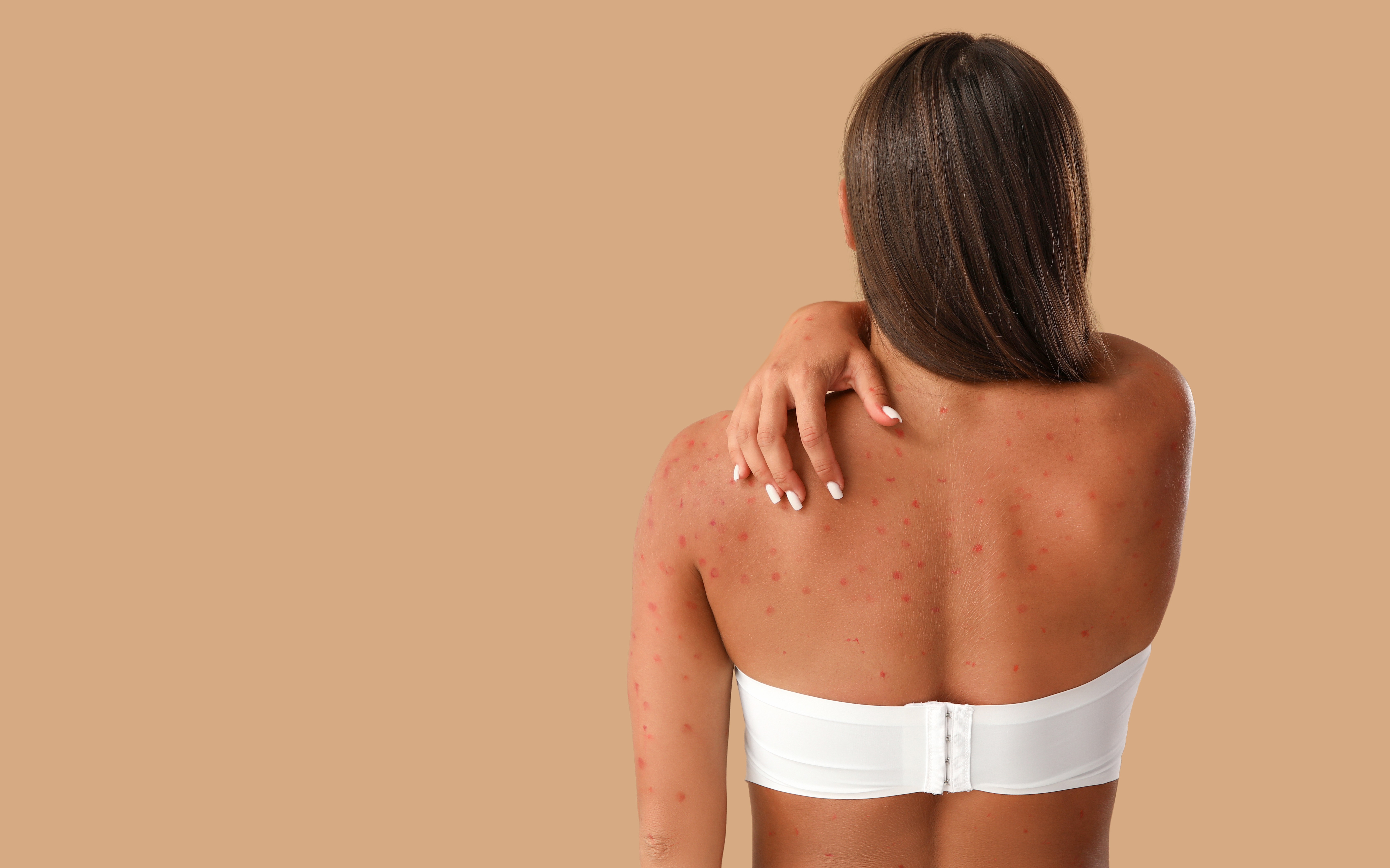 Bouton de varicelle : causes et symptomes - Aroma-Zone