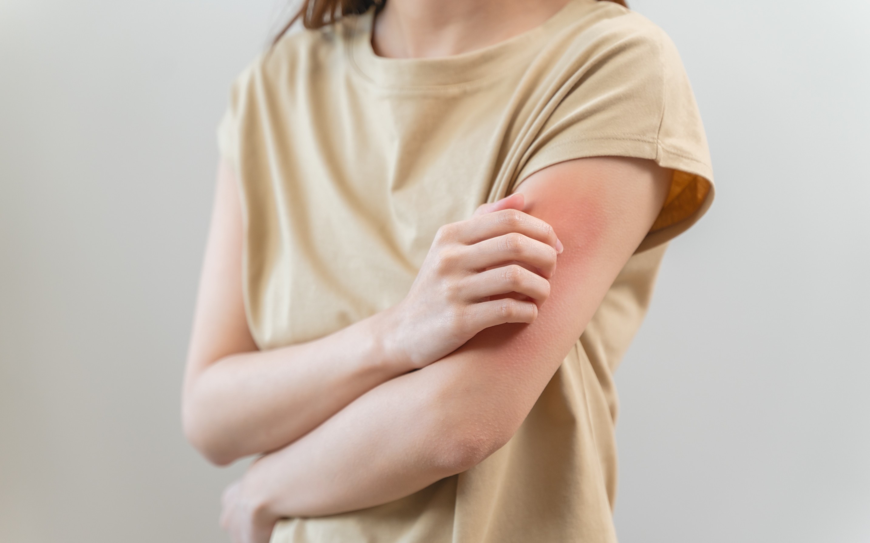 Tâche rouge sur la peau : pourquoi - Aroma-Zone