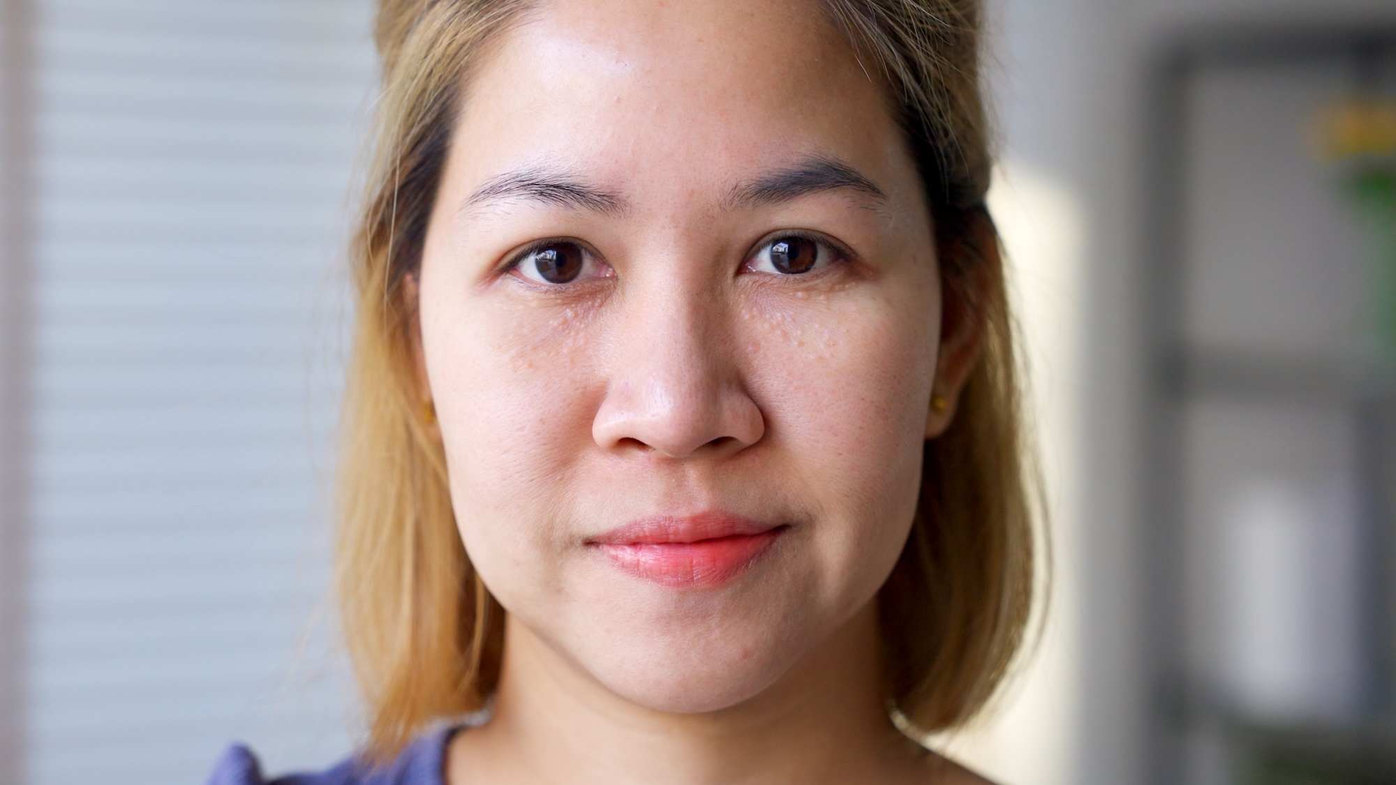 Grain de milium : causes et traitements efficaces - Aroma-Zone