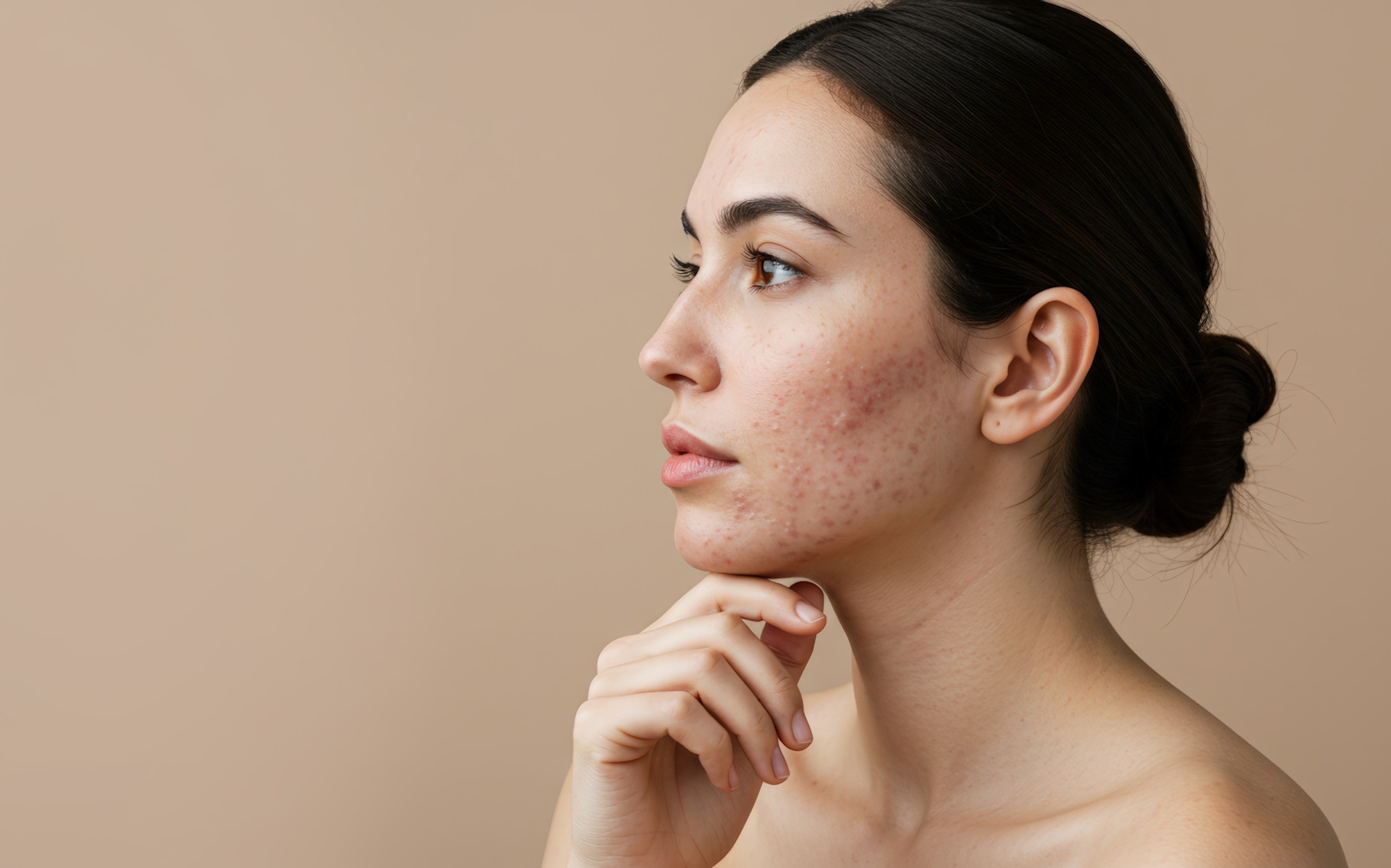 Excès de sébum au visage : quelles sont les causes ? - Aroma-Zone