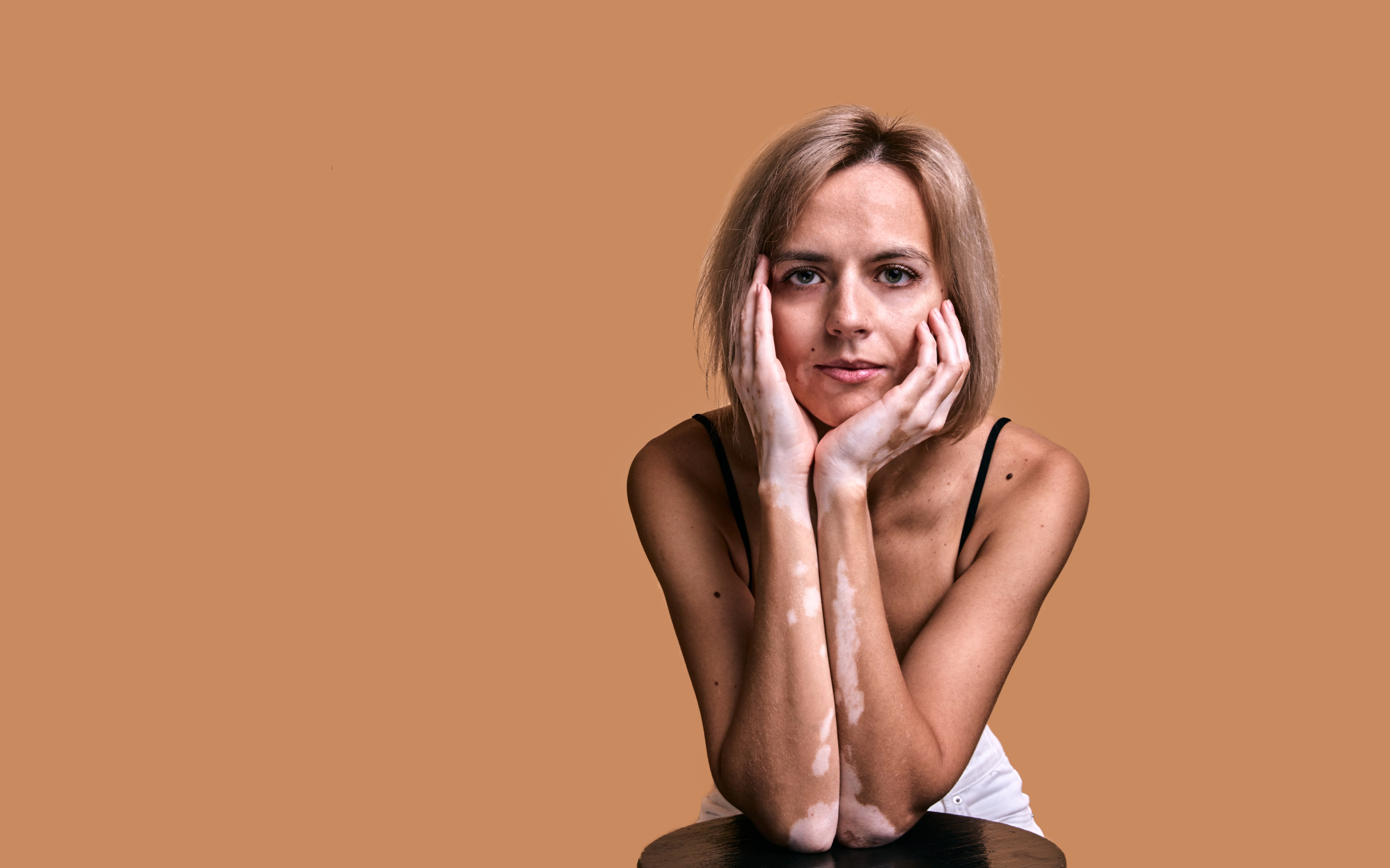 Pityriasis alba : causes et symptômes ? - Aroma-Zone