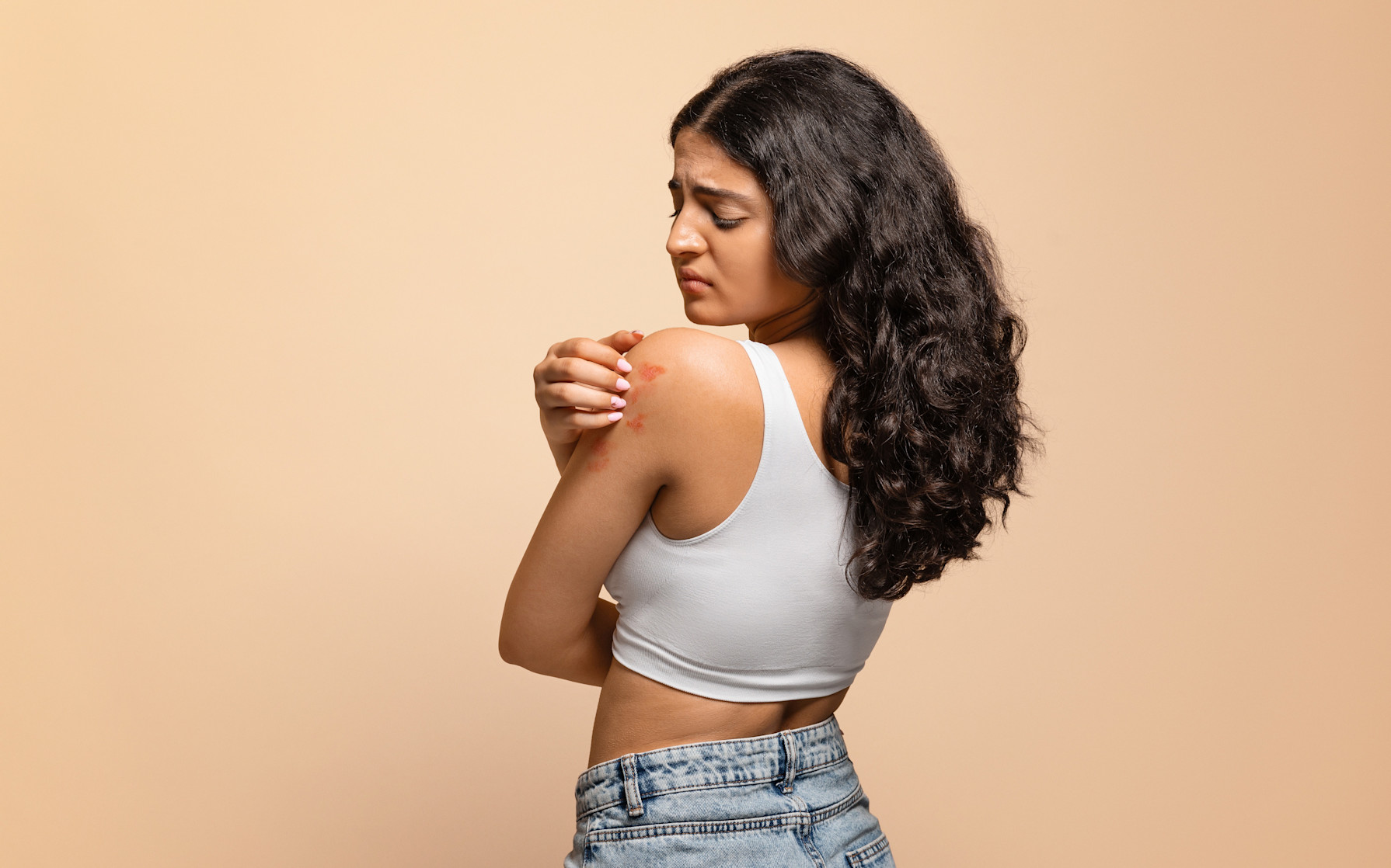 Dermatite atopique : Quels sont les causes et les symptômes ? - Aroma-Zone