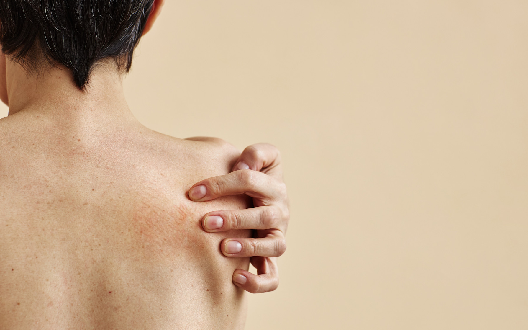 Prurit cutané : Causes et symptômes - Aroma-Zone