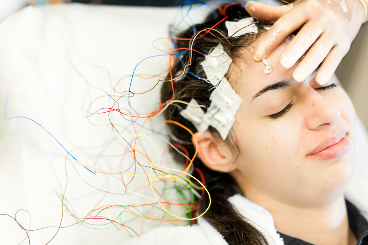 Psychogenic Non-Epileptic Seizures (PNES): Insights and Treatment