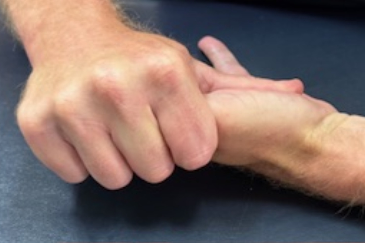 Root Cause of Carpal Tunnel Syndrome
