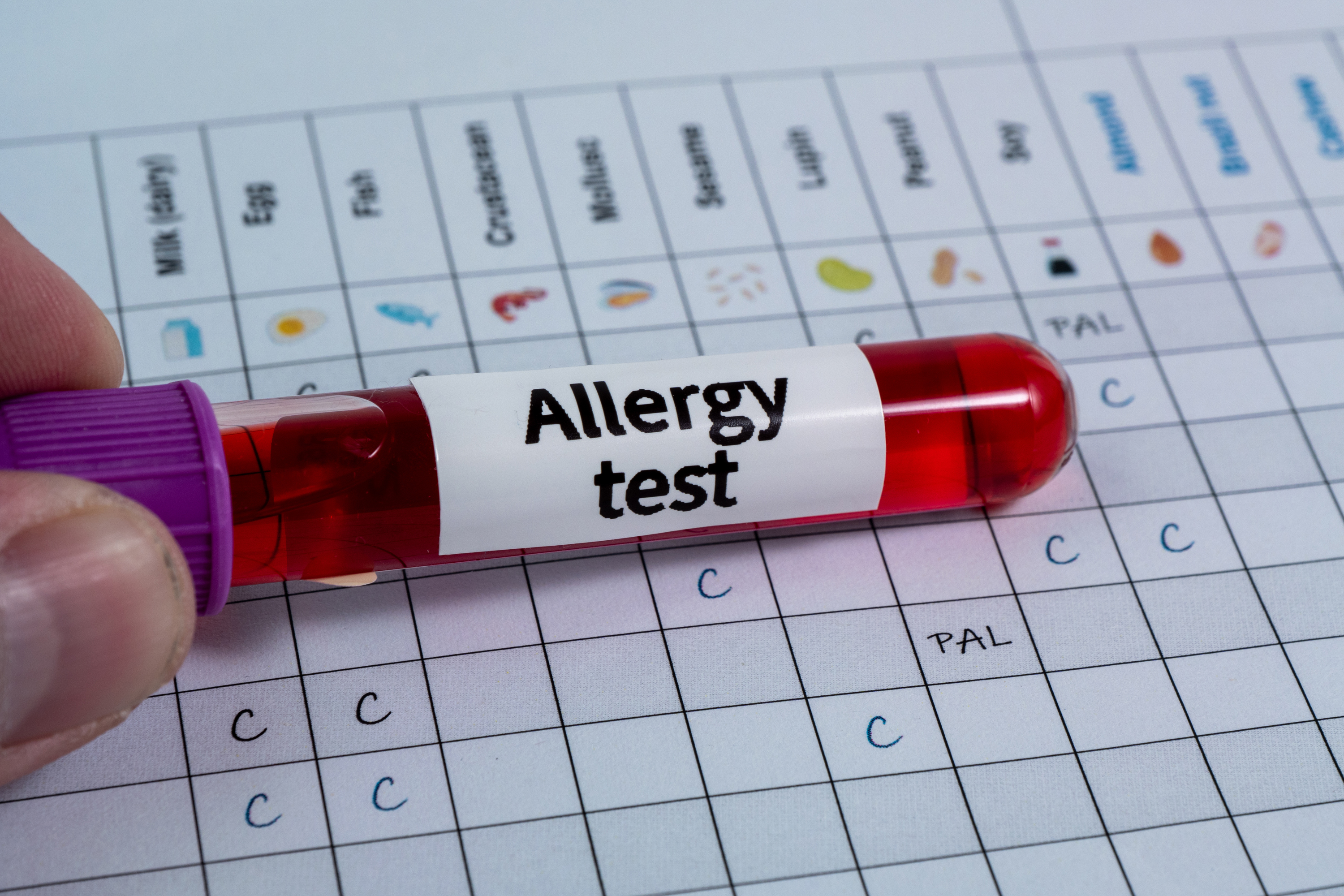Food Allergies: Why They Differ Among Racial and Ethnic Groups