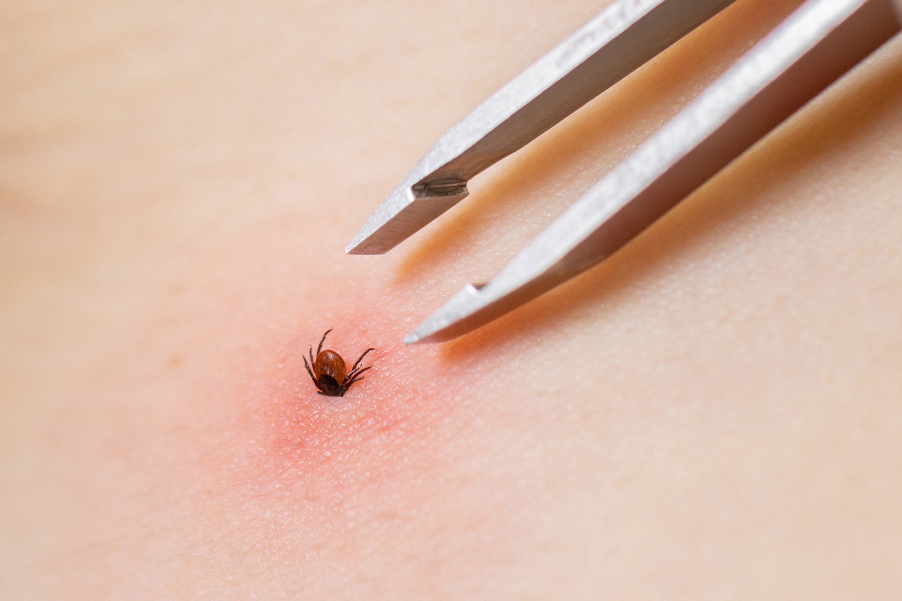 New Research, Drugs Aim to Combat the Chronic Nature of Lyme Disease