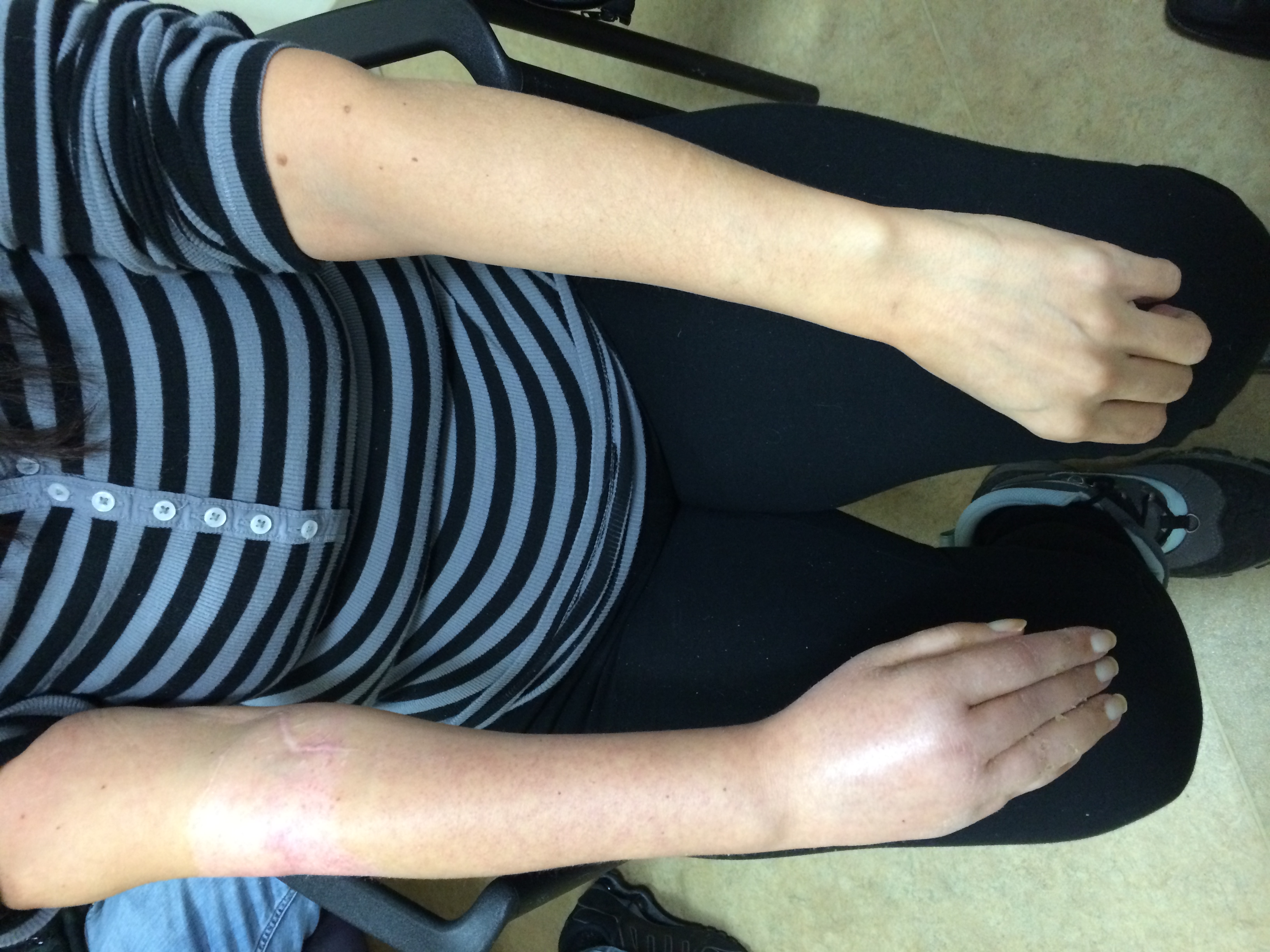 Cutaneous Manifestations of Painful Disorders