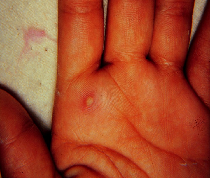 Skin Rash as the Initial Manifestation of Systemic Rheumatic Disease