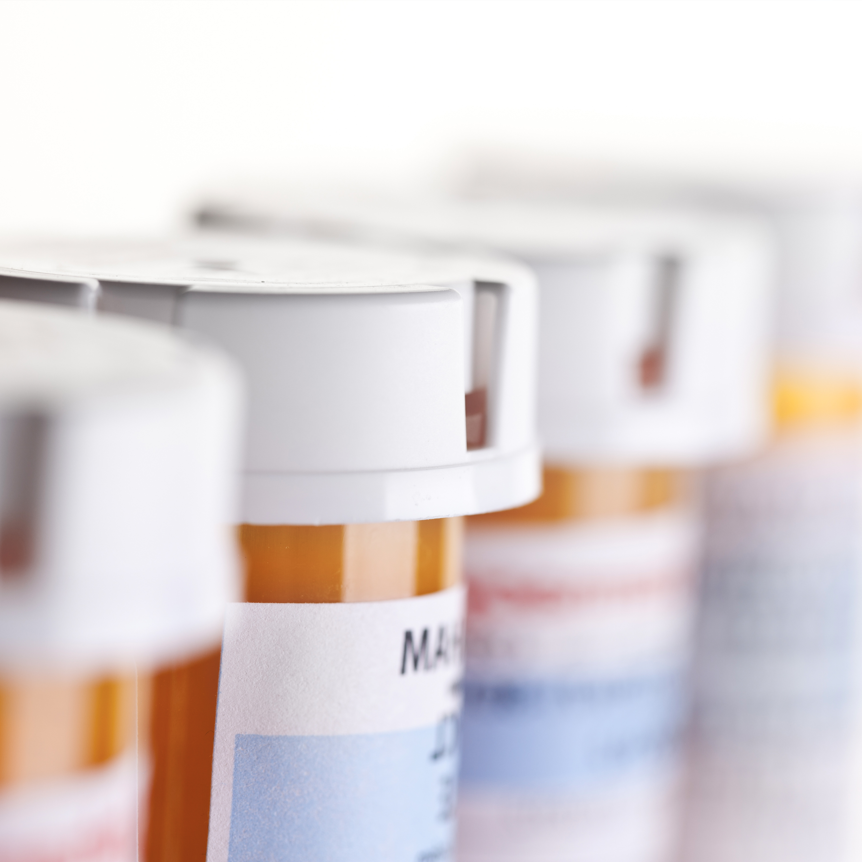 Systemic Lupus Erythematosus: A Clinical Overview