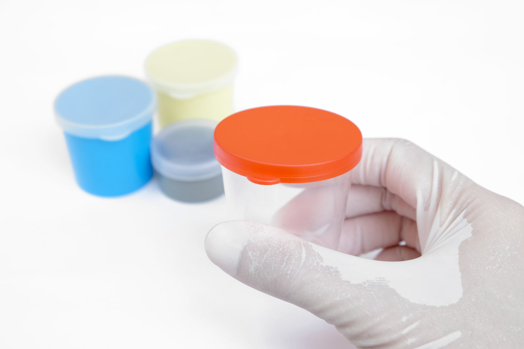 Urine Drug Monitoring