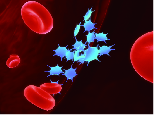 Platelet Rich Plasma for Hamstring Tears