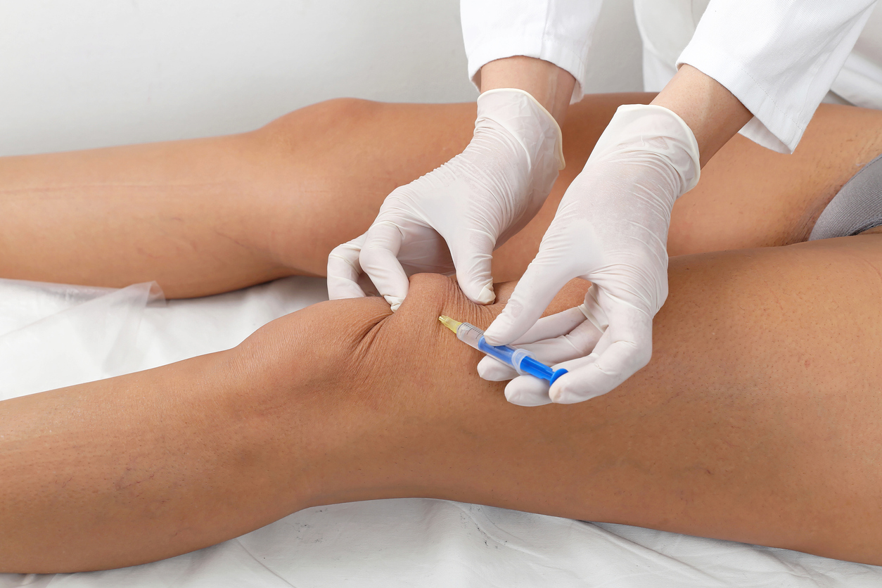 Using Botox to Treat Chronic Pain Conditions, including Osteoarthritis ...