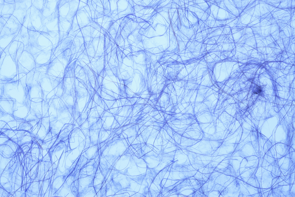 Multiple Sclerosis (MS) Types and Stages of Progression
