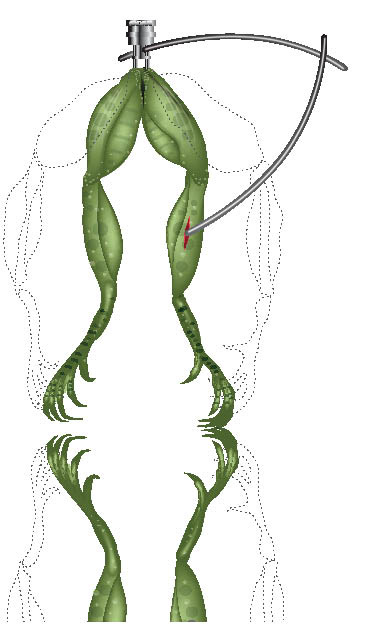 Understanding Electromagnetic Treatments