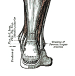 The Treatment of Achilles Tendonitis Using Therapeutic Laser
