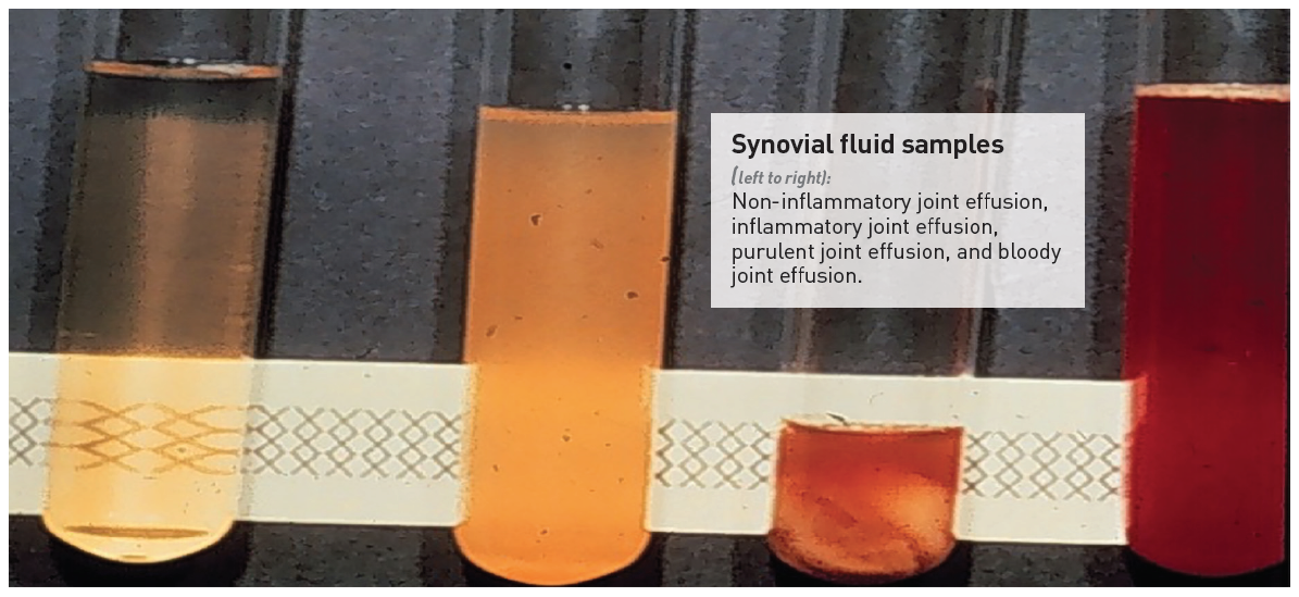 Guide to Laboratory Testing in Patients With Suspected Rheumatic Disease