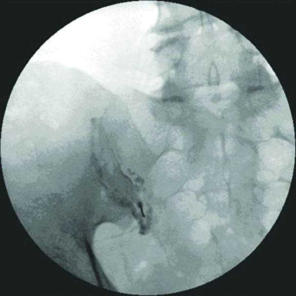 Evaluation and Management of Sacroiliac Joint Dysfunction