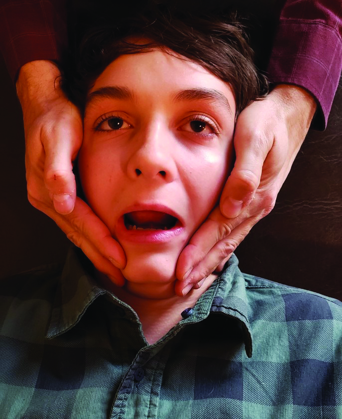 Managing Temporomandibular Disorders in Performance Artists