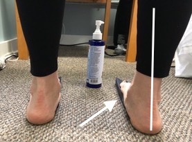 Morton’s Toe and Chronic Pain