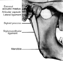 Dextrose Prolotherapy and Pain of Chronic TMJ Dysfunction