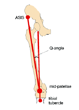 Need for More Accurate ER Diagnoses of ACL Injuries