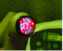 Effectiveness of Laser and Non-Coherent Light Therapies