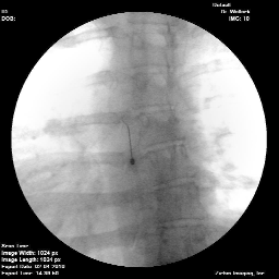 Introduction to a Referred Sympathetic Pain Map