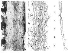 A Conceptual Model of Pain