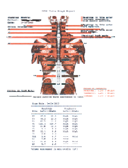 Objective Documentation of Spine Pain