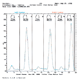 Objective Documentation of Spine Pain