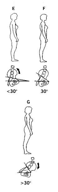 Myofascial Elements of Low Back Pain