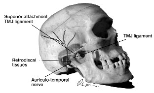 Temporomandibular Joint Referred Pain