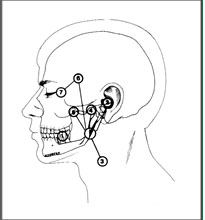Ernest Syndrome and Insertion of the SML at the Mandible