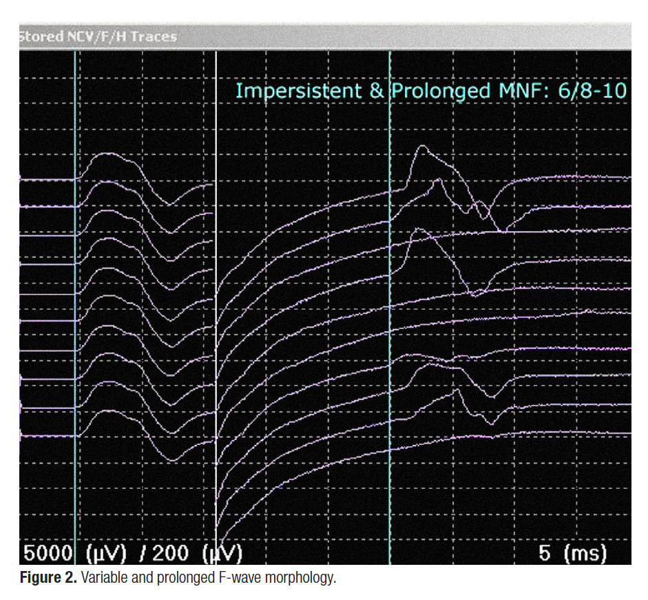 Diagnosis of Neck and Upper Extremity Pain