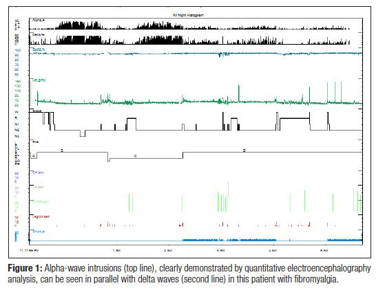 Sleep Apnea in Patients With Fibromyalgia: A Growing Concern