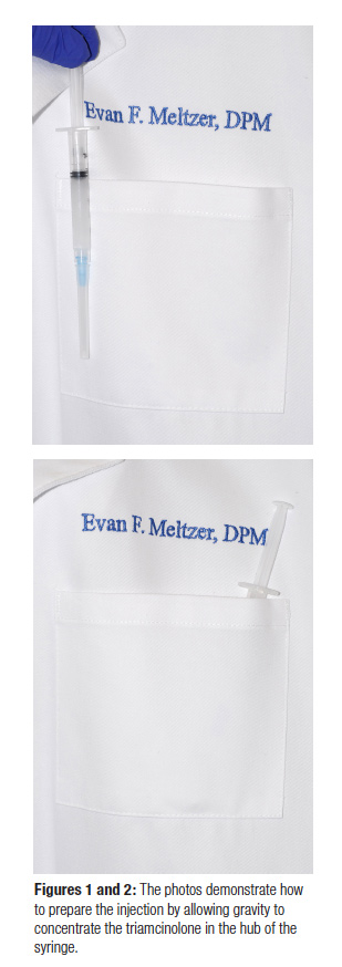 Effective Protocol for the Management of Plantar Fasciitis