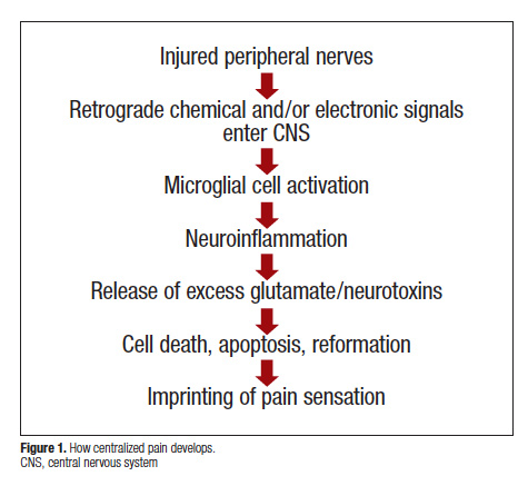 The Critical Necessity to Diagnose Pain That Is Centralized